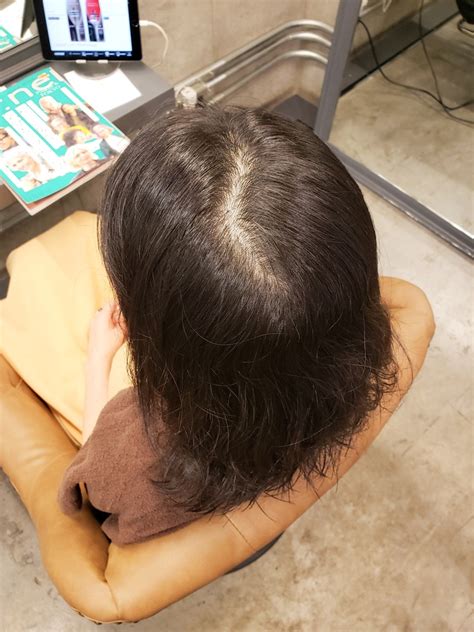 女性の薄毛を解消できる？！プリカールで髪のボリュームと自信を取り戻そう Magnolia マグノリア 東京・青山・表参道にあるパーマ専門店
