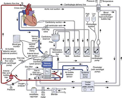 Heart Bypass Machine Diagram Bypass Circuit Drainage Pulmona