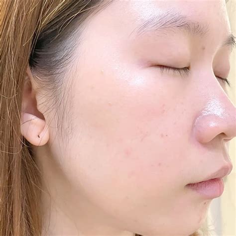 มือใหม่อนากลองวิตซีต้องตัวนี้เลย👍🏻 แกลเลอรีที่โพสต์โดย Annenosorus• ̎