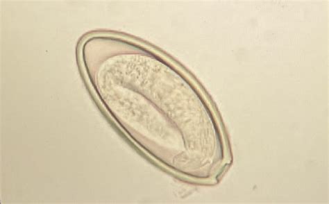 Acanthocephalans Hirudinea And Large Animal Parasites Flashcards
