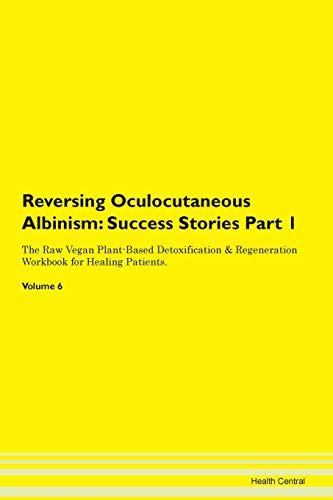Reversing Oculocutaneous Albinism Testimonials For Hope From Patients