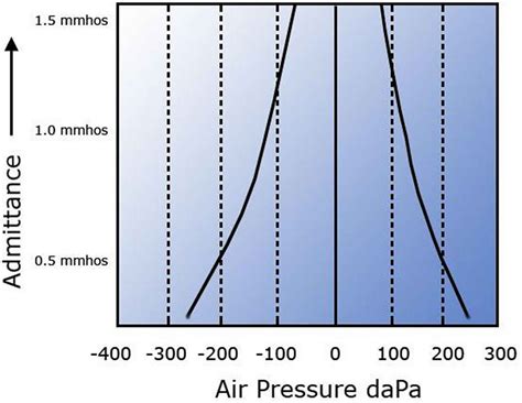 Tympanometry Test Tympanometry Types And Abnormal Tympanometry Results