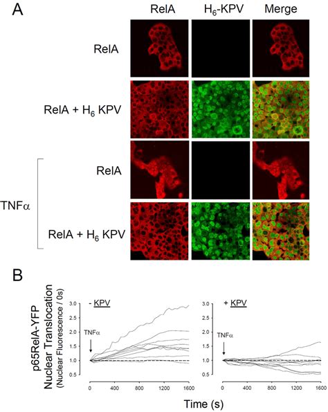 Kpv Inhibits Nuclear Translocation Of P65rela A Distribution Of
