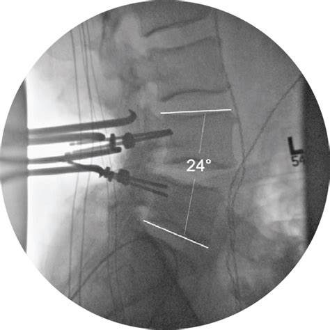 Proaxis Brochure Mizuho Osi