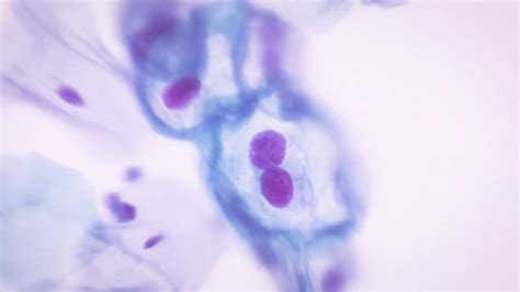 Diapath Spa On Linkedin Cytopath Line