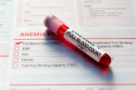 What Is A Full Blood Count What Does It Test For YorkTest