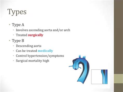 37 Aortic Dissection My Wiki