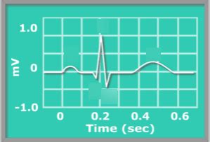 Ekg Diagram Quizlet