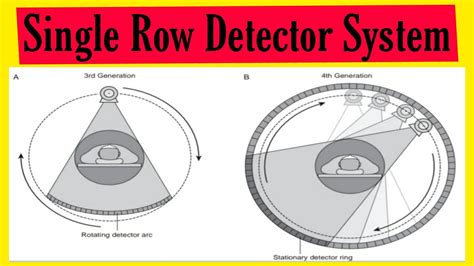 What Is Detector In Ct Scan At Carisa Macaulay Blog