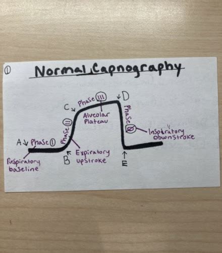 Etco2 Capnography Practice Flashcards Quizlet