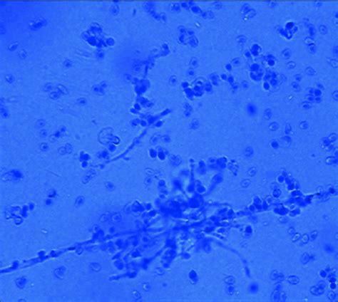 Trichophyton Mentagrophytes Download Scientific Diagram