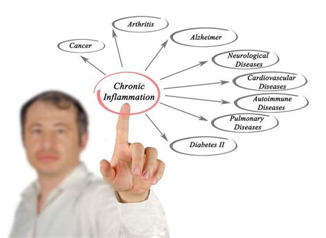 Anesthesia Experts On Linkedin Anesthesia Body Brain Inflammation