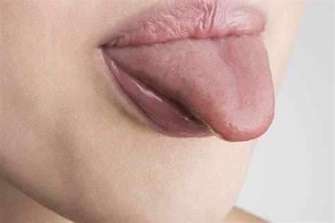Things That Can Cause A Swollen Tongue