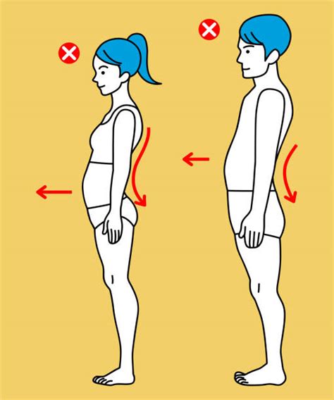 Swayback Exercises