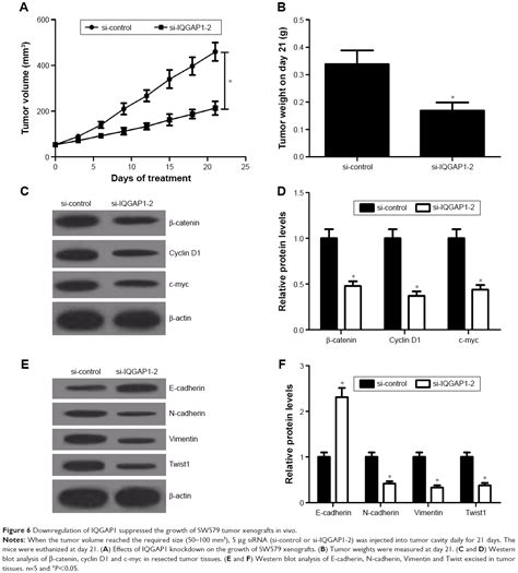Knockdown Of Iqgap1 Inhibits Proliferation And Epithelial Mesenchymal Ott