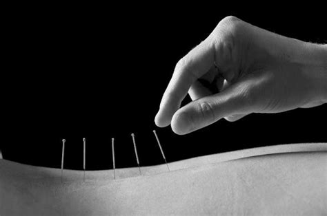 Reviews Of Timaru Acupuncture Clinic Acupuncture Clinic In Timaru