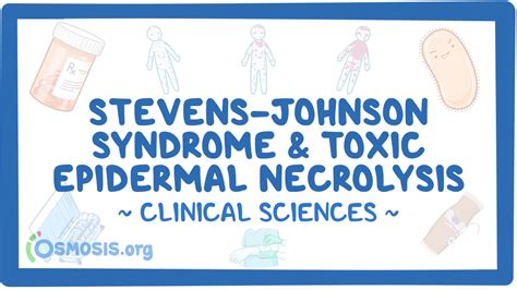 Stevens Johnson Syndrome And Toxic Epidermal Necrolysis Video