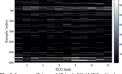 Figure 1 From Block Sparse Multi Lead Ecg Compression Exploiting Between Lead Collaboration