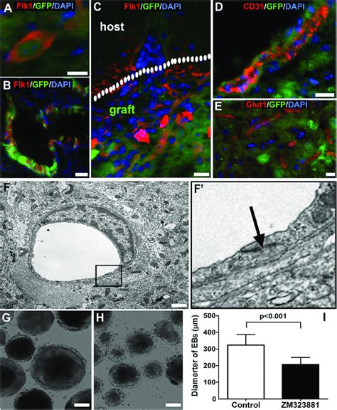 Vasculogenesis In The Graft A GFP Flk1 Cells Are Present In The