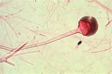Rhizopus Sporangium