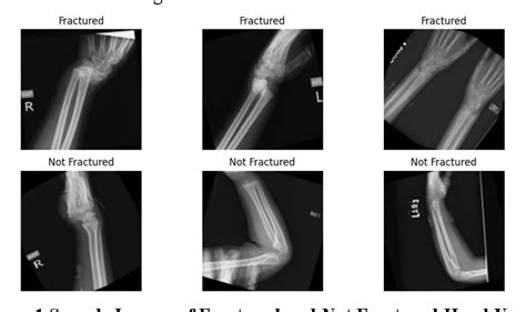Figure 1 From Comparative Analysis Of Neural Network Architectures For Automated Fracture