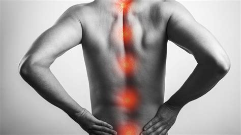 Comparing Common Spine Conditions Herniated Discs Vs Spinal Stenosis