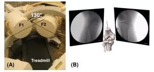 PPT Treadmill Stress Test PowerPoint Presentation Free Download ID