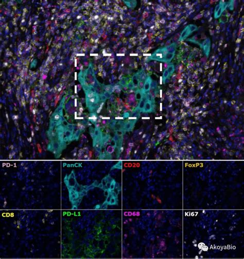 组织切片多色荧光（mif Mihc）最多能做几色？看9 40色标记分析如何轻松实现 成像