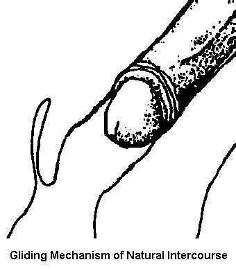 Circumcision Harms Sex