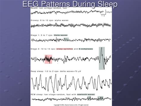 PPT EEG Patterns During Sleep PowerPoint Presentation Free Download ID