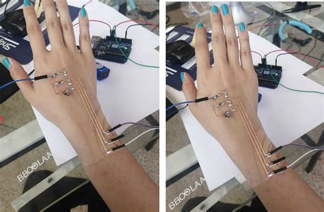 Skin Electronics
