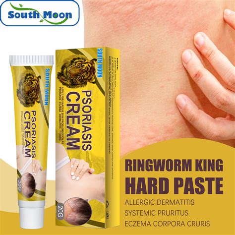 Eczema Cream Seborrheic Dermatitis Cream Anti Itch Cream Extra Strength Jock Itch Cream