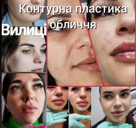 ☀️☀️ПРИВІТ КРАСУНІ🌹🌹🌹 🌈🌈🌈🌈ЗАПРОШУЮ ВАС НА ТАКІ ПРОЦЕДУРИ 🌈🌈🌈🌈🌈 КОНТУРНА