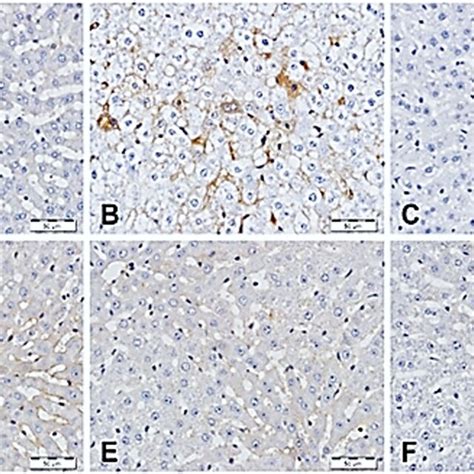 Immunoreactive Signal Of Collagen Iii In Rat Liver Sections Of Liver
