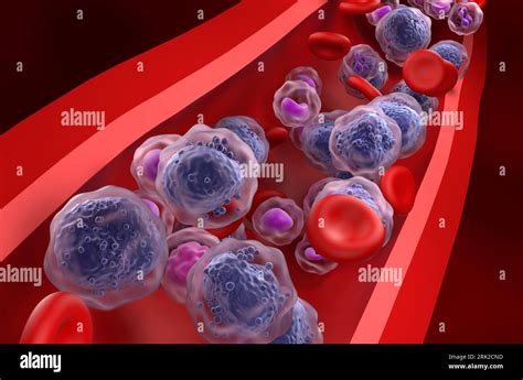 Acute Myeloid Leukemia Aml Cells In Blood Flow Closeup View 3d