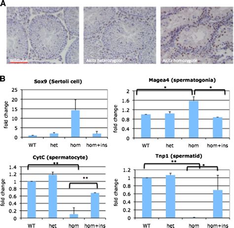 Testicular Cell Types Affected By Lack Of Functional Insulin A Testes