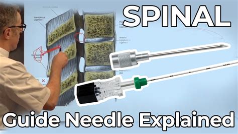 Neuraxial Anatomy Nysora Anesthesia Spinal Spinal Cor