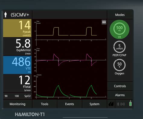Difference Between Cmv And Simv