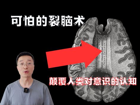 如果切断你大脑之间的连接会怎么样？ 李论科学 李论科学 哔哩哔哩视频