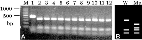 Nested Pcr Rflp Analysis Of The Dhps Gene A Cfr13i Digestion Of Dhps