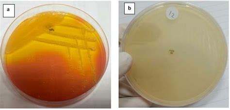 Conventional Identification Of Methicillin Resistant Staphylococcus