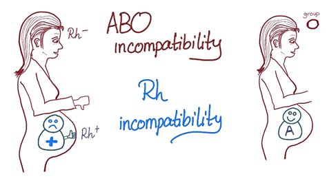 Abo Incompatibility Vs Rh Incompatibility Youtube