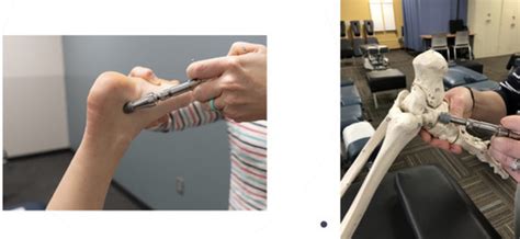 Assisted Adjusting Activator Flashcards Quizlet