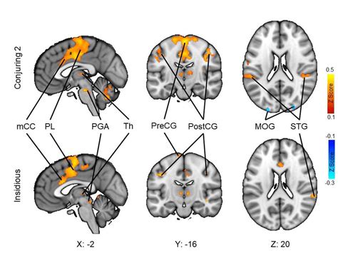 Fear Dependent Dynamic Inter Subject Neural Synchronization For The Download Scientific Diagram