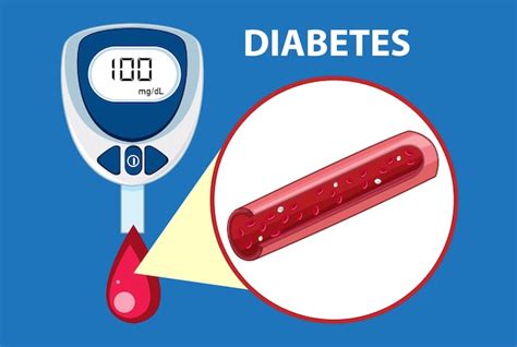 Monitoring Glucose Levels Vectors And Illustrations For Free Download