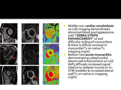 Approach To Hfref Pptx