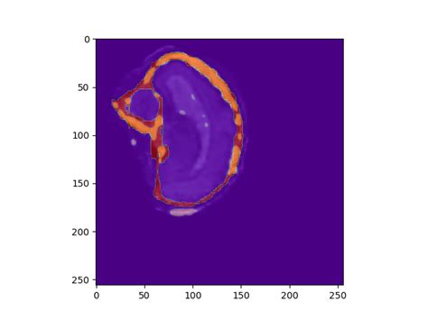 GitHub Laz4rz MulticlassBrainSegmentation UNET Based Multiclass