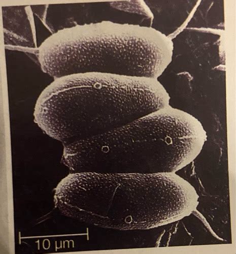 Microscopes Flashcards Quizlet