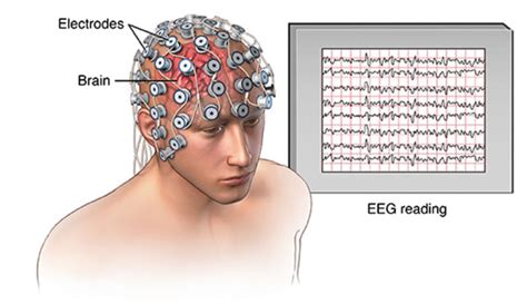 1 Illustration For Eeg Records 50 Download Scientific Diagram