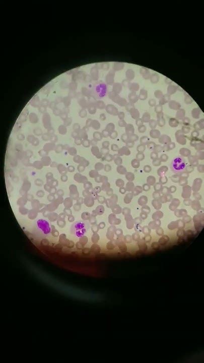 Neutrophils Lymphocyte Slide View Under Microscope 🔬🔬 Ytshorts Microscope Youtube